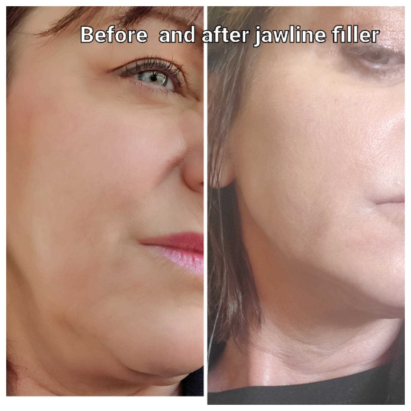 Amazing high G prime filler